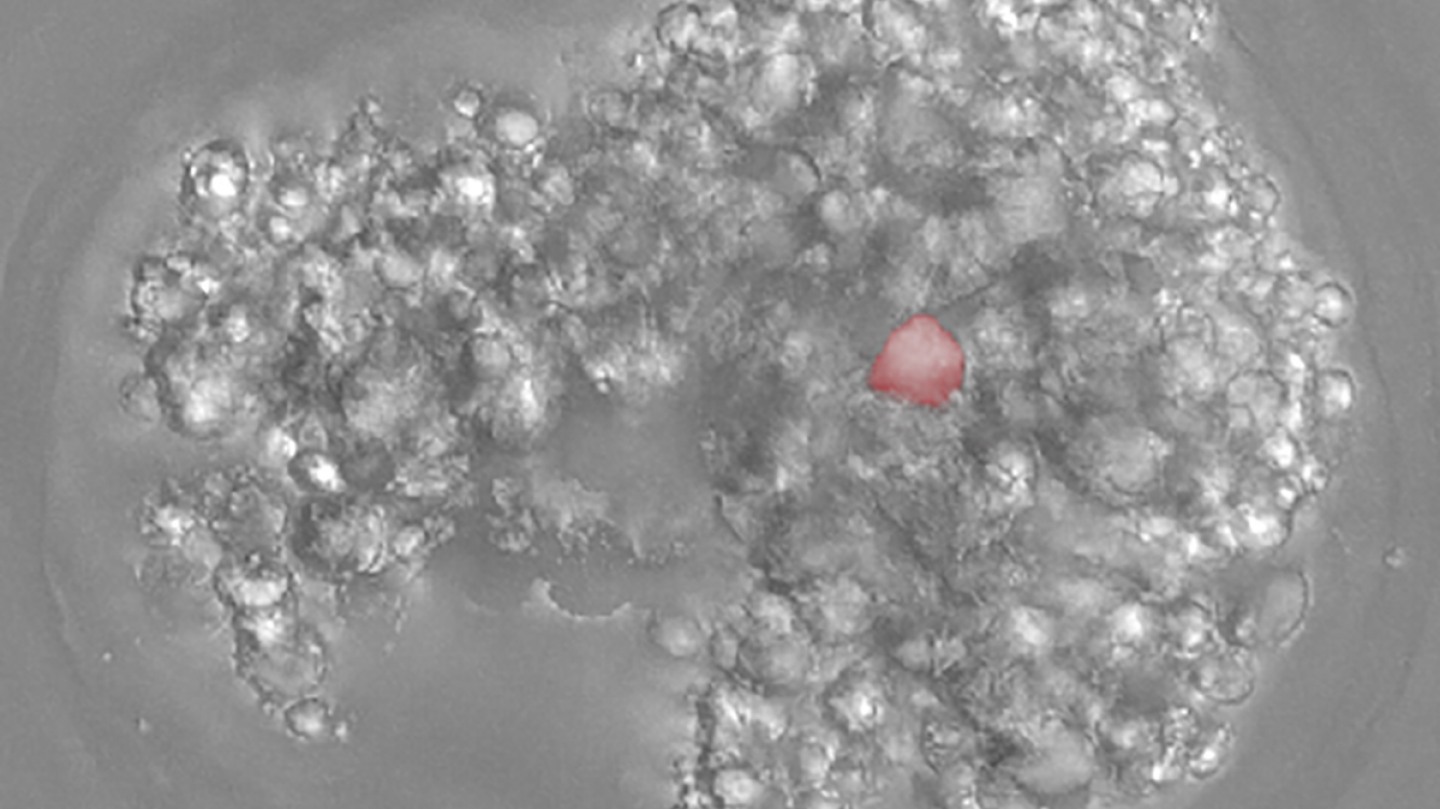 Tiny sensor technique reveals cellular forces involved in tissue ...