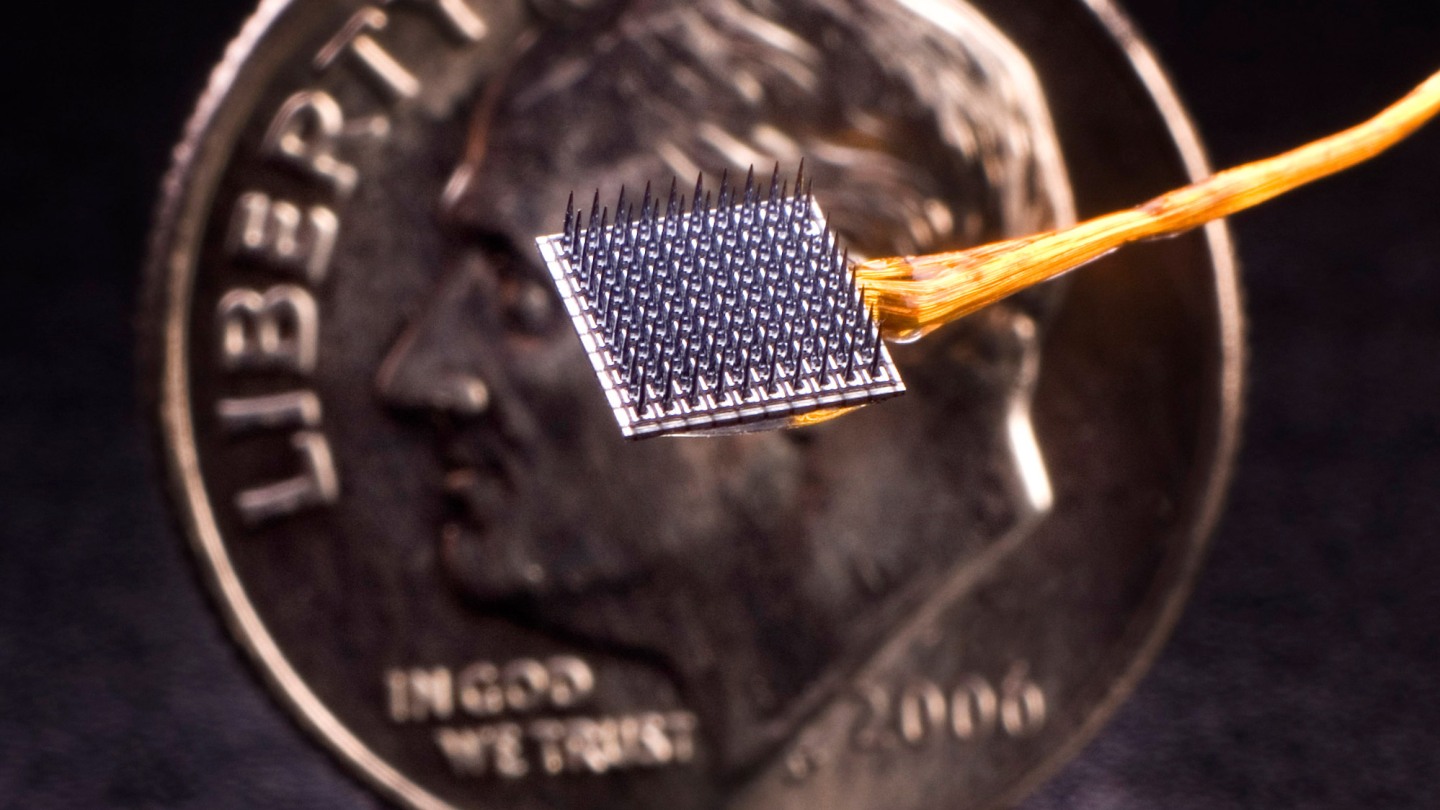 Clinical trials show encouraging safety profile for brain-computer ...