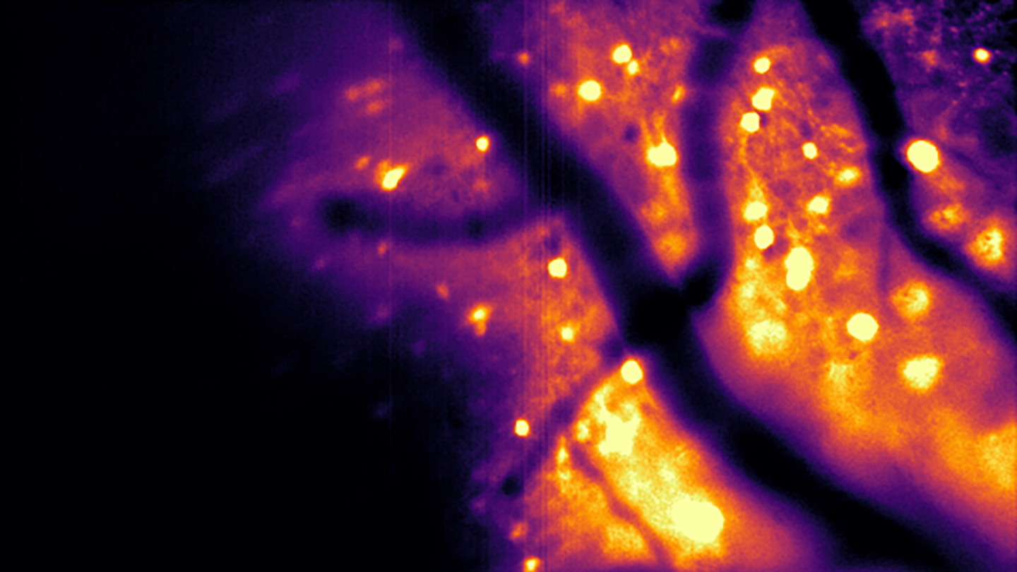 bioluminescence imaging