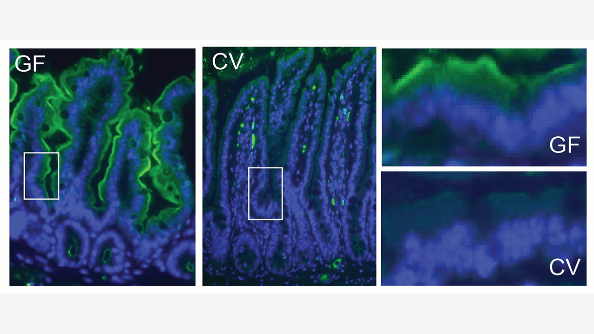 Gut microbiome regulates the intestinal immune system, researchers find ...