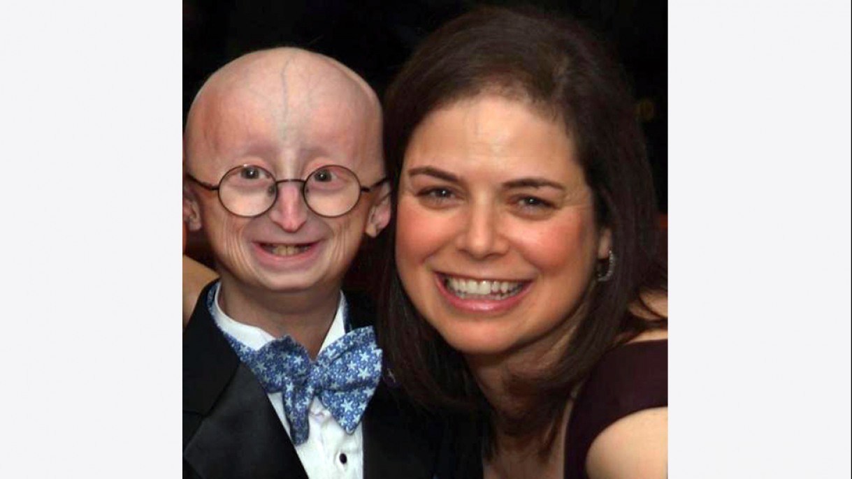 Research suggests promising drug therapy for premature aging disease ...