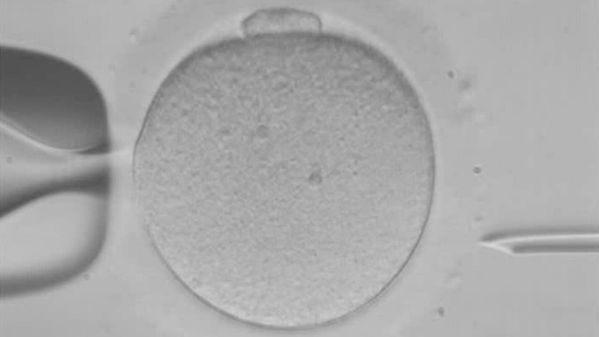 Technology to screen embryos before implantation falls short | Brown ...