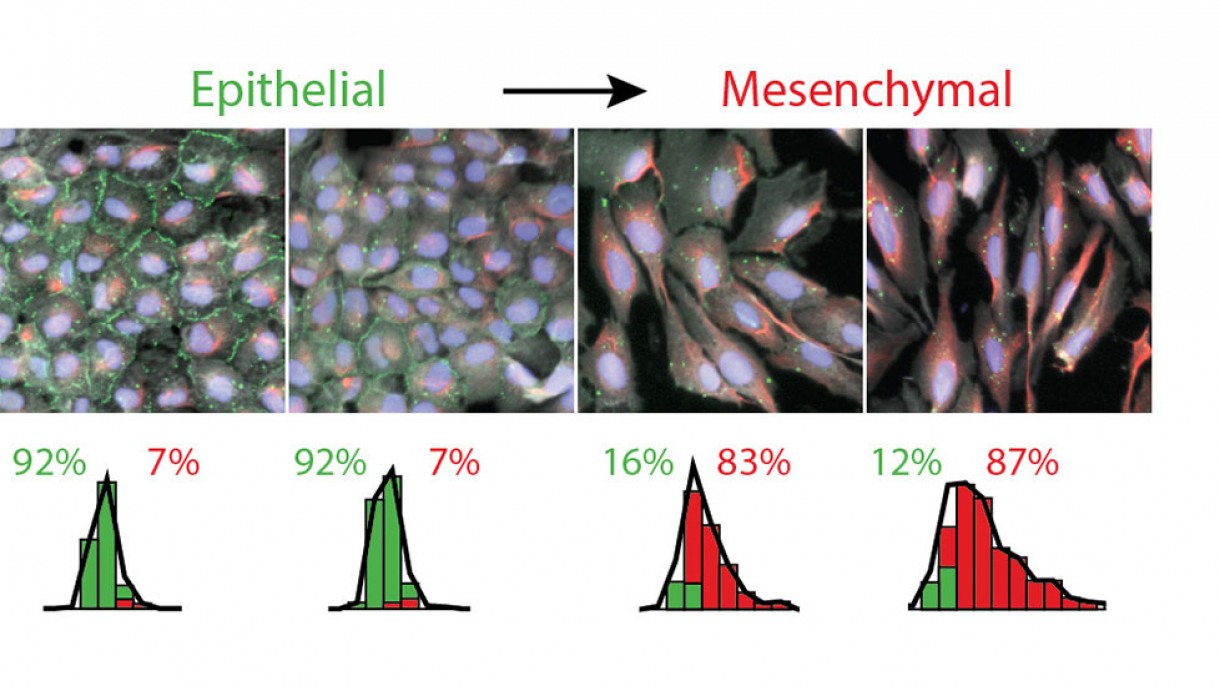 Machine learning technique helps identify cancer cell types | Brown ...