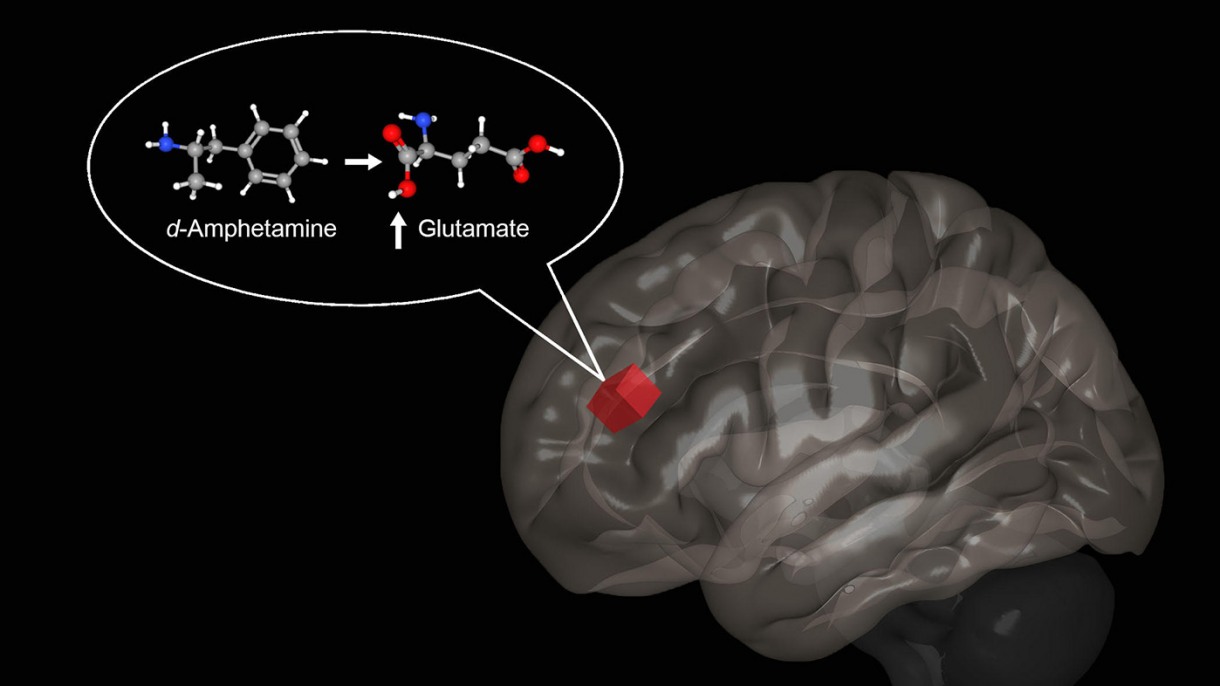 Imaging rapid drug effects in the human brain | Brown University