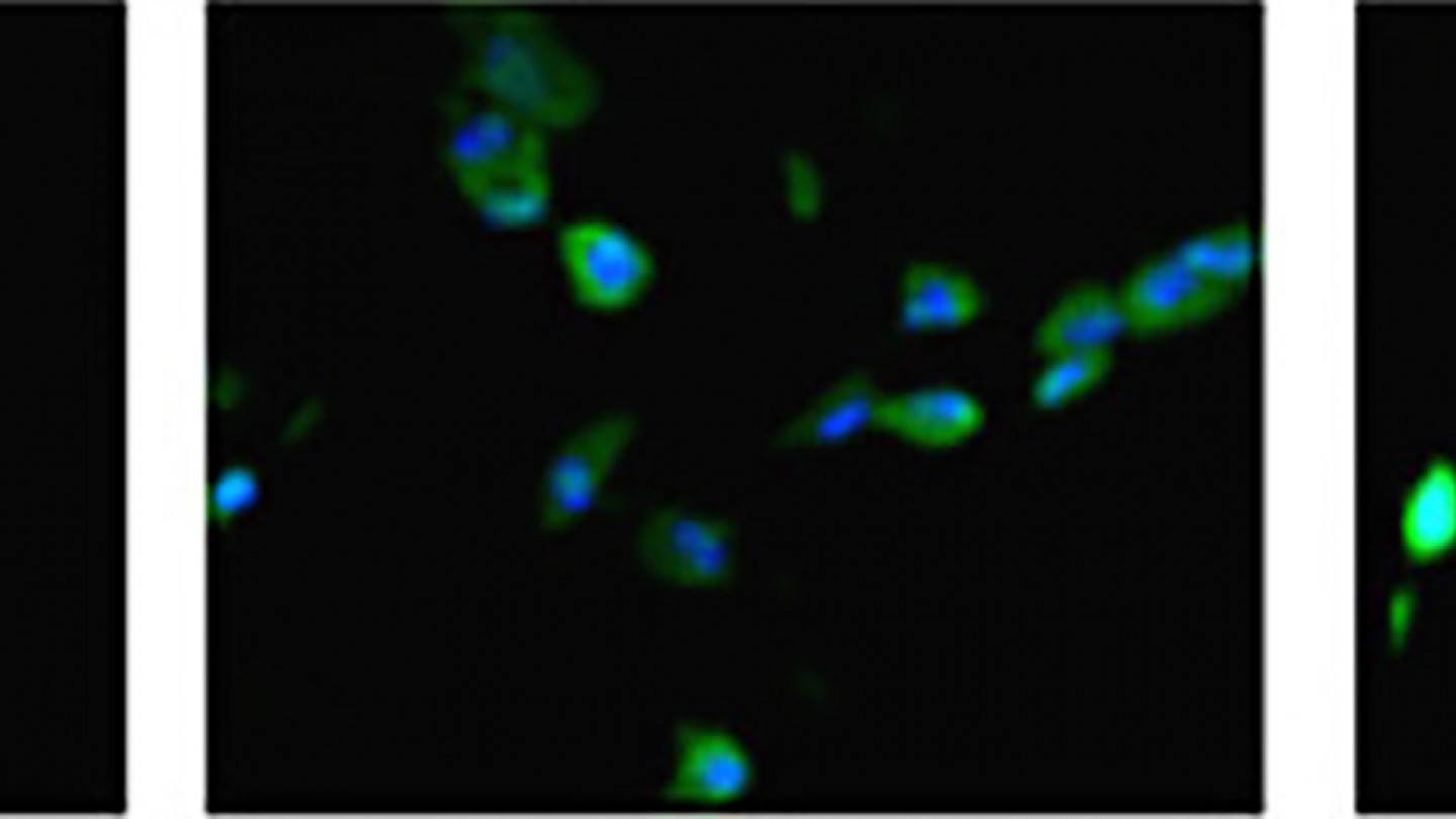 Formaldehyde damages proteins, not just DNA | Brown University